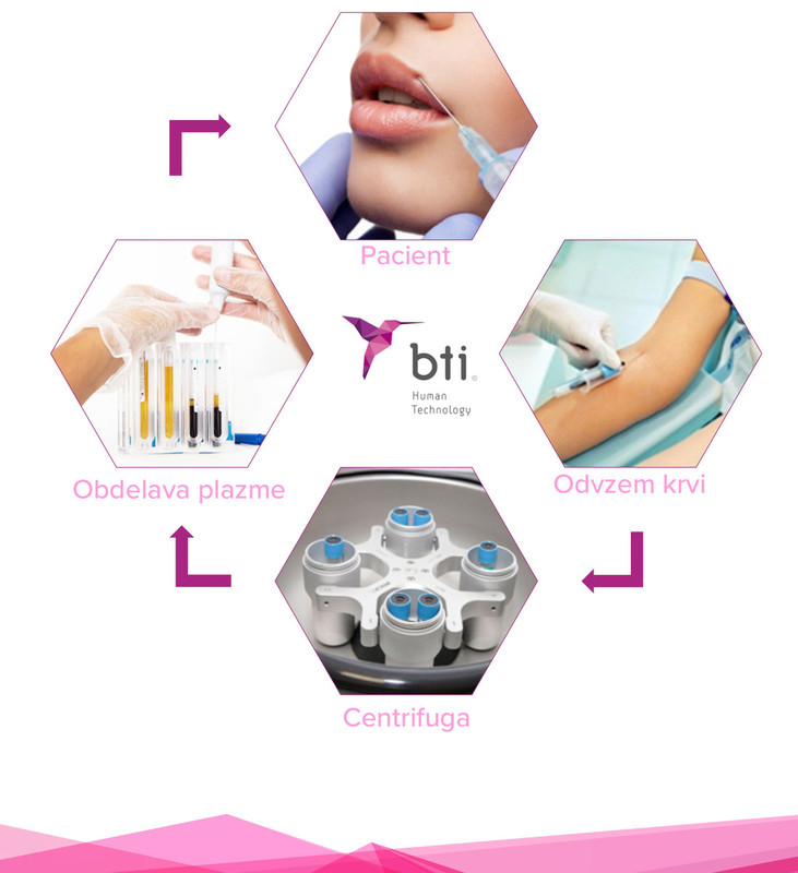 Uporaba tehnologije PRGF Endoret in implantatnega sistema BTI v ...